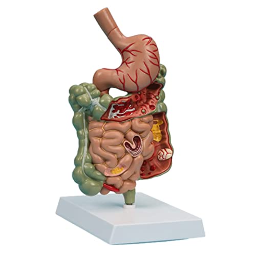 PAASHE Anatomy Model Human Stomach Anatomy Model Organs Model Human Body Model Stomach Section Large Small Intestine Medical Model Study Education