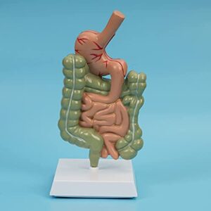 PAASHE Anatomy Model Human Stomach Anatomy Model Organs Model Human Body Model Stomach Section Large Small Intestine Medical Model Study Education