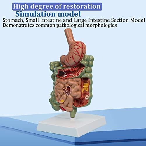 PAASHE Anatomy Model Human Stomach Anatomy Model Organs Model Human Body Model Stomach Section Large Small Intestine Medical Model Study Education