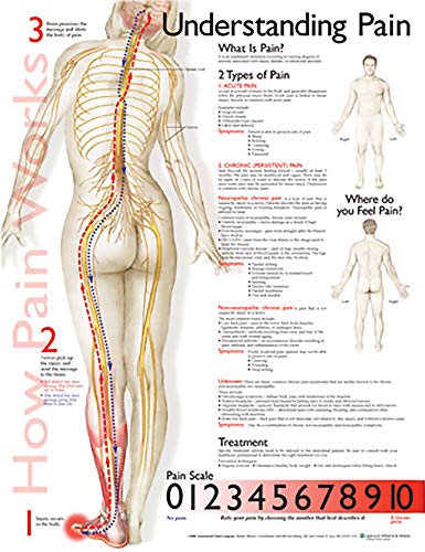 Understanding Pain Anatomical Chart