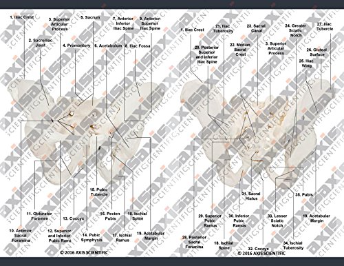 Axis Scientific Male Pelvis Model, Life Size Pelvic Human Anatomy Features Hip, Sacrum, and Coccyx, Includes Detailed Manual