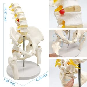 Evotech Male Pelvis Model with 5 Lumbar Spine, W/Removable Femur Head, Life Size Anatomy Medical Model for Science Education, Medical Demonstration Tool