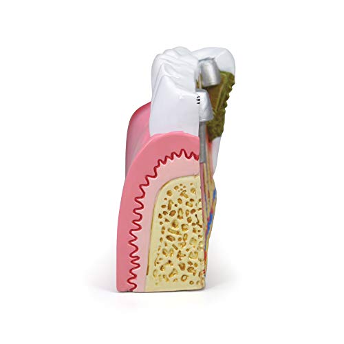 Dental Model | Human Body Anatomy Replica of Teeth w/Common Pathologies for Dentist Office Educational Tool | GPI Anatomicals