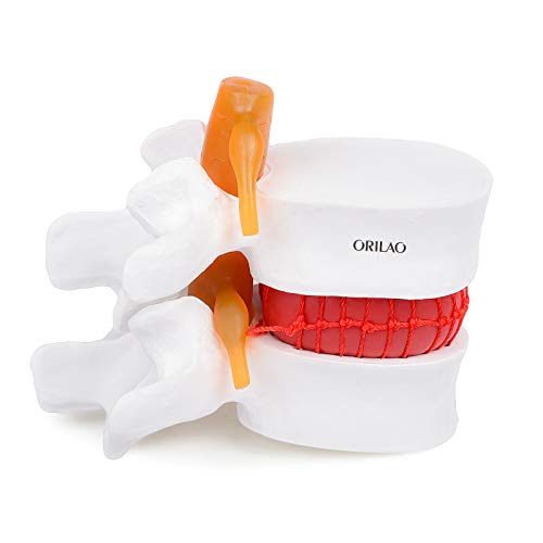 Human 1:1.5 Anatomical Lumbar Vertebral Spine Model,Vertebral Spine Anatomical for Study Eucation White Color