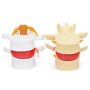 Human 1:1.5 Anatomical Lumbar Vertebral Spine Model,Vertebral Spine Anatomical for Study Eucation White Color