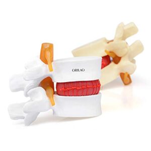 Human 1:1.5 Anatomical Lumbar Vertebral Spine Model,Vertebral Spine Anatomical for Study Eucation White Color