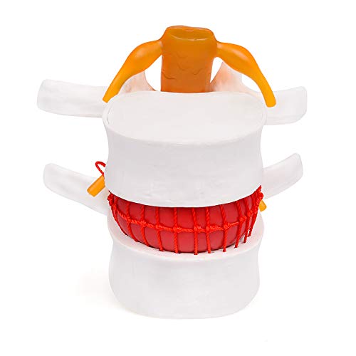 Human 1:1.5 Anatomical Lumbar Vertebral Spine Model,Vertebral Spine Anatomical for Study Eucation White Color