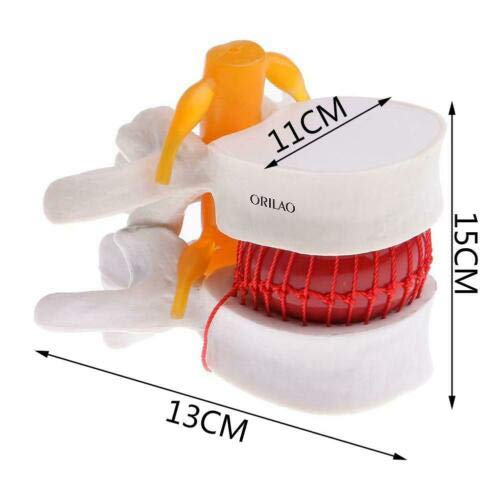 Human 1:1.5 Anatomical Lumbar Vertebral Spine Model,Vertebral Spine Anatomical for Study Eucation White Color