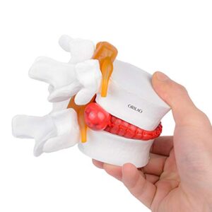 Human 1:1.5 Anatomical Lumbar Vertebral Spine Model,Vertebral Spine Anatomical for Study Eucation White Color