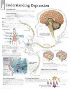 understanding depression chart: wall chart