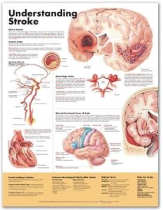 understanding stroke anatomical chart