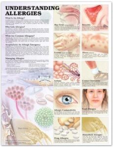 understanding allergies anatomical chart