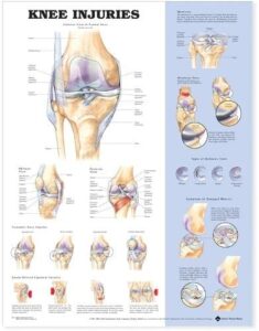 knee injuries anatomical chart