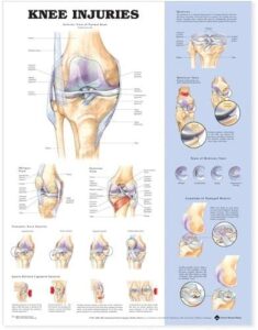 knee injuries anatomical chart