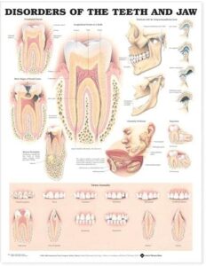 disorders of the teeth and jaw anatomical chart