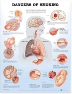 dangers of smoking anatomical chart