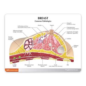 Breast Cross-Section Model | Human Body Anatomy Replica of Breast w/Common Pathologies for Doctors Office Educational Tool | GPI Anatomicals