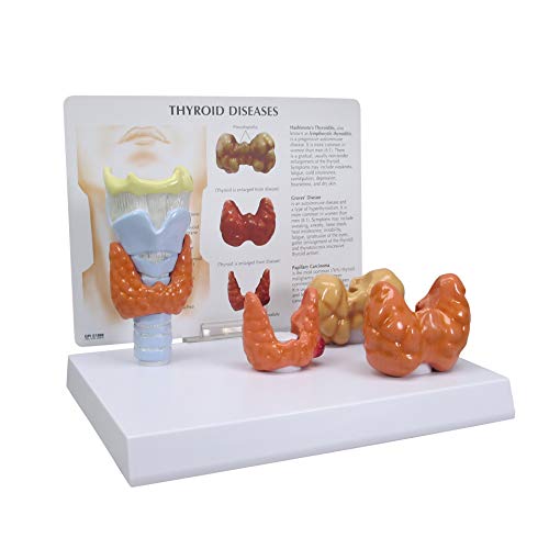 Thyroid Model Set | Human Body Anatomy Replica of Thyroid w/Diseases for Doctors Office Educational Tool | GPI Anatomicals