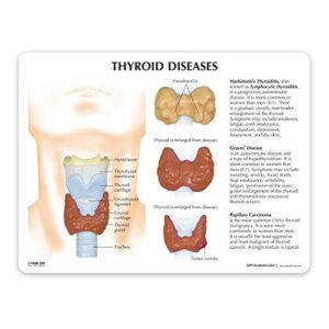 Thyroid Model Set | Human Body Anatomy Replica of Thyroid w/Diseases for Doctors Office Educational Tool | GPI Anatomicals