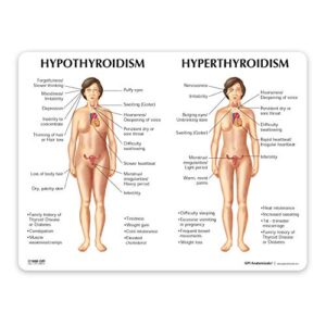 Thyroid Model Set | Human Body Anatomy Replica of Thyroid w/Diseases for Doctors Office Educational Tool | GPI Anatomicals