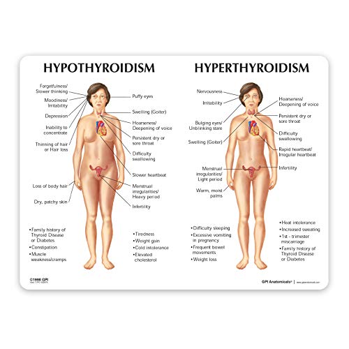 Thyroid Model Set | Human Body Anatomy Replica of Thyroid w/Diseases for Doctors Office Educational Tool | GPI Anatomicals