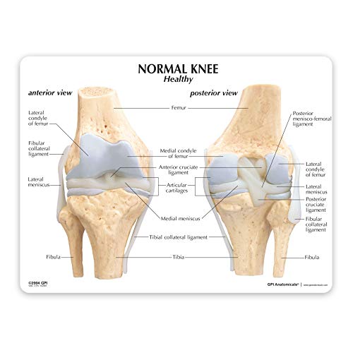 GPI Anatomicals Knee Joint Model Set | Human Body Anatomy Replica Set of 4-Stage Osteoarthritis Knee Joint for Doctors Office Educational Tool