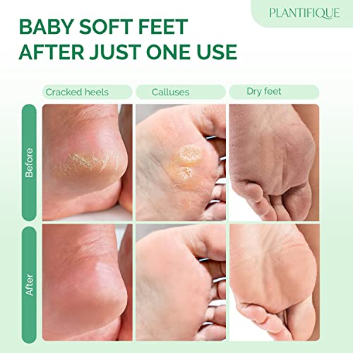 Foot Peel Mask with Peach by Plantifique - 2 Pack Peeling Foot Mask Dermatologically Tested - Repairs Heels & Removes Dry Dead Skin for Baby Soft Feet - Exfoliating Foot Peel Mask for Dry Cracked Feet