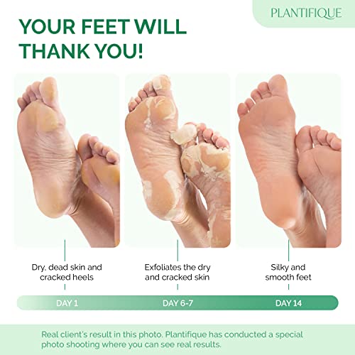 Foot Peel Mask with Peach by Plantifique - 2 Pack Peeling Foot Mask Dermatologically Tested - Repairs Heels & Removes Dry Dead Skin for Baby Soft Feet - Exfoliating Foot Peel Mask for Dry Cracked Feet