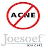 JOESOEF SKIN CARE Sulfur Soap for Acne Pharmaceutical Grade Dermatologists Approved for Acne Rosacea 100G