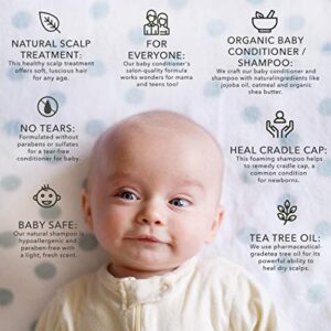 BELLA B Cradle Cap Shampoo & Cradle Cap Scalp Treatment And Conditioner - Baby Shampoo And Conditioner - Cradle Cap Shampoo For Babies - Kid Shampoo - Dry Scalp Shampoo And Conditioner For Dry Scalp