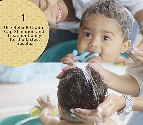 BELLA B Cradle Cap Shampoo & Cradle Cap Scalp Treatment And Conditioner - Baby Shampoo And Conditioner - Cradle Cap Shampoo For Babies - Kid Shampoo - Dry Scalp Shampoo And Conditioner For Dry Scalp