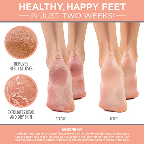 Hicream Foot Peel Mask- 2 Pairs of Regular Skin Exfoliating Foot mask For Cracked Heels, Dead Skin & Calluses , Removes & Repairs Rough Heels, Dry Toe Skin , Peach Scent