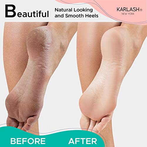 Karlash Professional Pedicure Foot Pumice Stone for Feet Skin Callus Remover and Scrubber for Dead Skins 2 Sided (Pack of 2)