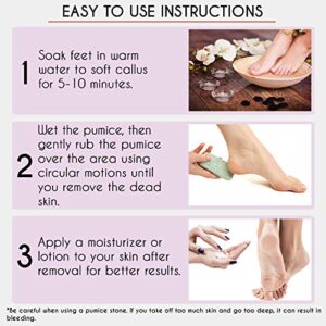 Karlash Professional Pedicure Foot Pumice Stone for Feet Skin Callus Remover and Scrubber for Dead Skins 2 Sided (Pack of 2)