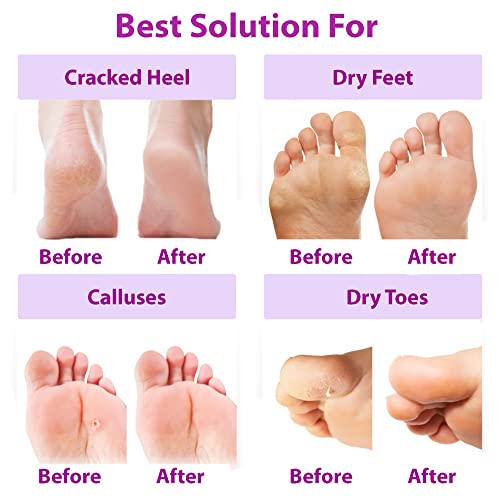 Foot Peel Mask by C&M Goods Co, Callus Remover for Feet 3 Pack of Foot Exfoliator Peeling Mask, Repairs Cracked Heels, Dead Skin, Baby Soft Smooth Touch Feet, Foot Callus Remover for Men and Women