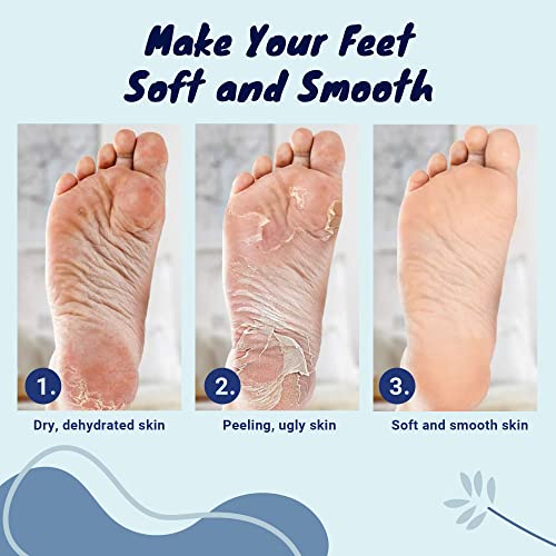 Melzu Foot Peel Mask for Enhanced Foot Care, Repair Heels & Removes Dry Dead Skin for Soft Baby Feet, Exfoliating Foot Peel Mask for Hard Skin. Natural, Easy to Use at Home, Fits for Women & Men (1 pair)