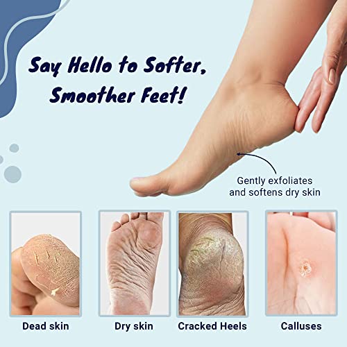 Melzu Foot Peel Mask for Enhanced Foot Care, Repair Heels & Removes Dry Dead Skin for Soft Baby Feet, Exfoliating Foot Peel Mask for Hard Skin. Natural, Easy to Use at Home, Fits for Women & Men (1 pair)