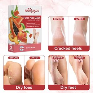 Normace Exfoliating Foot Mask( 2 Pairs) With All Passing Microbial Tests In USA LAB for Dry, Cracked Feet, Callus, Dead Skin Remover For Soft Baby Feet