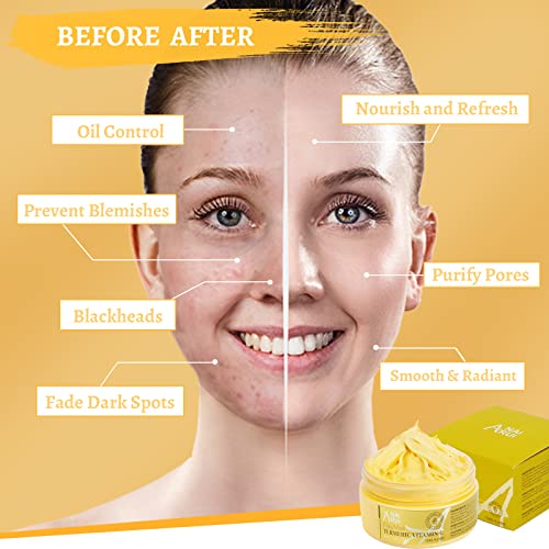 ANAIRUI Turmeric Vitamin C Clay Mask for Dark Spots, Vitamin C Clay Facial Mask for Blackheads, Pores, Wrinkles, Fine Lines, Hydrating, Clarifying, Cleansing Skincare Mask, 4.23 OZ