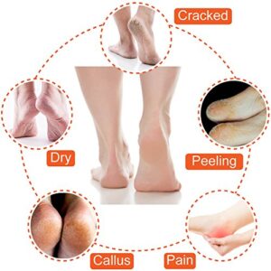 Selizo 5 Pairs Moisturizing Gel Heel Socks Open Toe Socks for Dry Hard Cracked Heels, 5 Colors