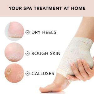 Kitsch Moisturizing Spa Socks - Gel Socks for Cracked Heel Repair | Heel Socks for Dry Cracked Feet | Dry Feet Treatment for Women | Cracked Feet Treatment | Toeless Socks for Women | Foot Care