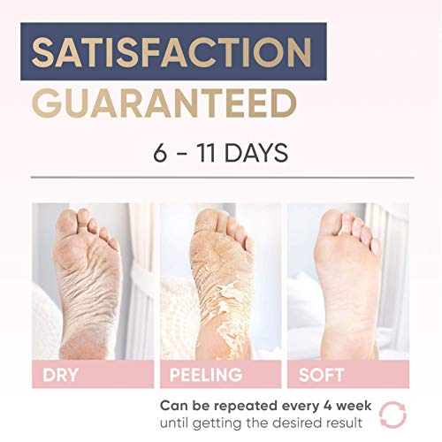 Peel Mask for Dry Hard Feet - Dead Skin & Callus Remover - Foot Spa Experience at Home for Baby Soft Feet - Large Size Exfoliating Socks for Woman and Man - Foot Care Treatment for Healthy Feet 8 Pack