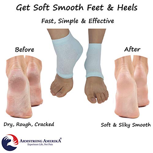 Moisturizing Socks for Cracked Heel Repair - Dry Heels Treatment for Rough Feet, Toeless Aloe Lotion Moisturizer Silicone Gel Lined Moisture Spa Heel Socks Pedicure Foot Care for Women Men Fits Most