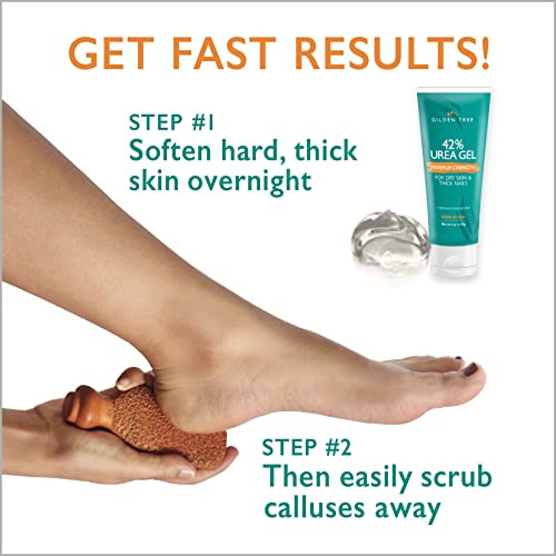 Callus Remover Gel + Foot Scrubber Kit - Pedicure Tools for Dry Cracked Heels