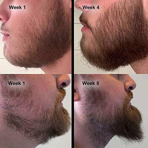 Beard Growth Kit - Hair Growth & Hair Serum - Beard Growth Oil and Beard Roller - Hair Growth for men - Stimulate Beard Growth with our Beard Serum and Growth Roller