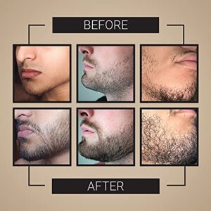 Beard Growth Kit - Hair Growth & Hair Serum - Beard Growth Oil and Beard Roller - Hair Growth for men - Stimulate Beard Growth with our Beard Serum and Growth Roller