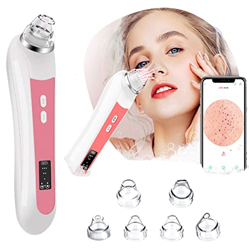 Blackhead Remover Wurkkos Pore Vacuum with Camera Black Head Remove Tools Acne Comedone Pimple Extractor with 6 Suction Heads for Phone,Tablet PC,Computer Facial Suctioner for Women & Men(Pink)