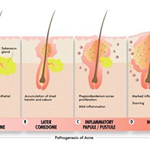 Non-Comedogenic Hair Conditioner for Blemish Free Skin by Clear 2 Perfection with Fresh Cells Strawberry and Kiwi Suspensions. Hair Conditioner for Acne. Made in USA