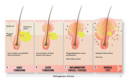 Non-Comedogenic Hair Conditioner for Blemish Free Skin by Clear 2 Perfection with Fresh Cells Strawberry and Kiwi Suspensions. Hair Conditioner for Acne. Made in USA