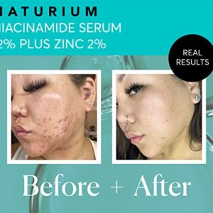 Naturium Niacinamide Face Serum 12% Plus Zinc 2%, Hyaluronic Acid & Vitamin E, Pore Minimizer, Discoloration & Aging Skin Treatment, 1 oz